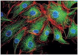 iFLEX Viper laser engine for innovative benchtop cytometer